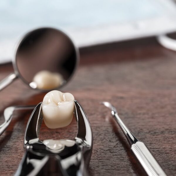 Wisdom Teeth Removal Recovery Timeline: Complete Guide