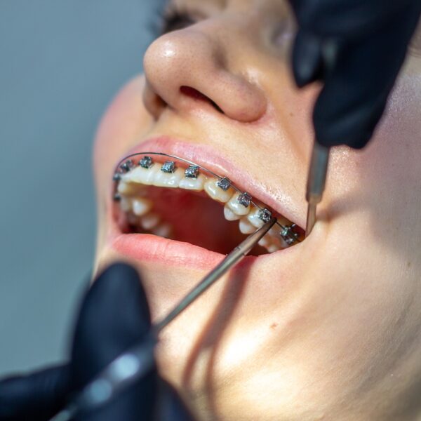 Benefits of Salt Water Mouth Rinse - Modern Dental Hygiene